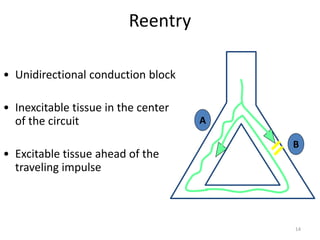 Mechanism of Arrhythmias .pdf
