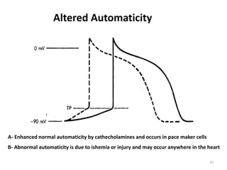 Mechanism of Arrhythmias .pdf