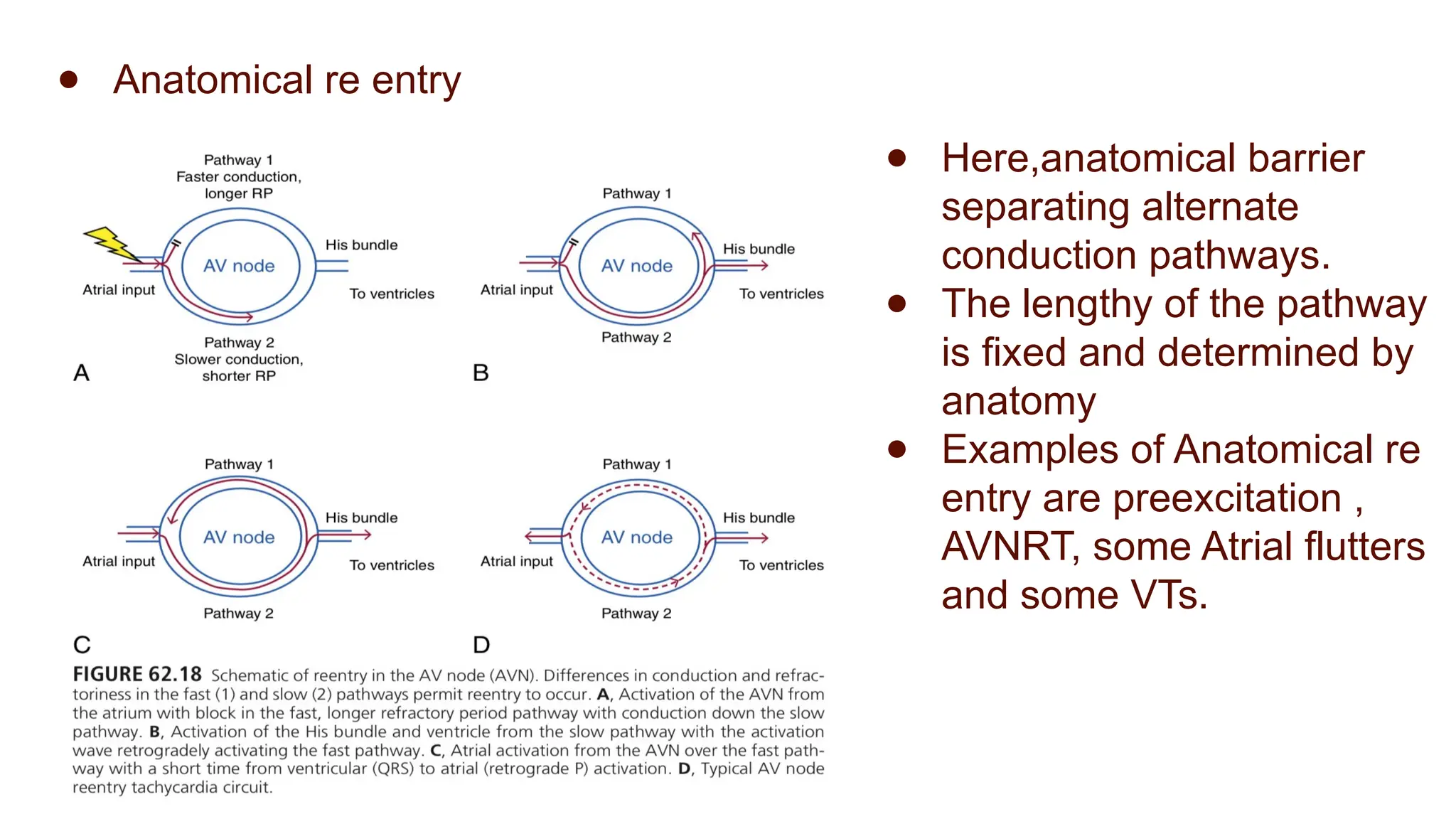 Mechanism of Arrhythmias and mechanism of drugs for respective ...