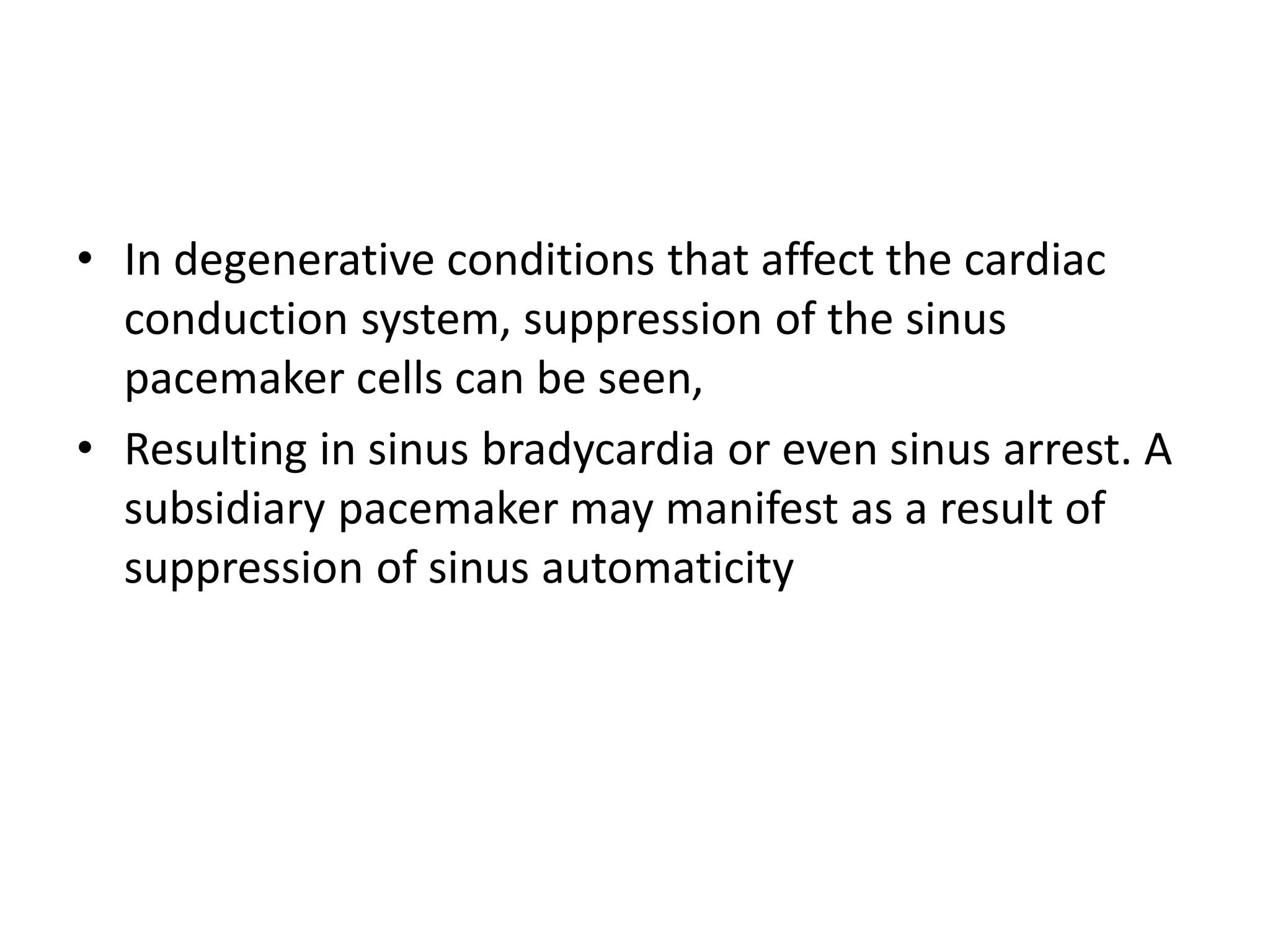 Mechanism of arrythmias | PPTX