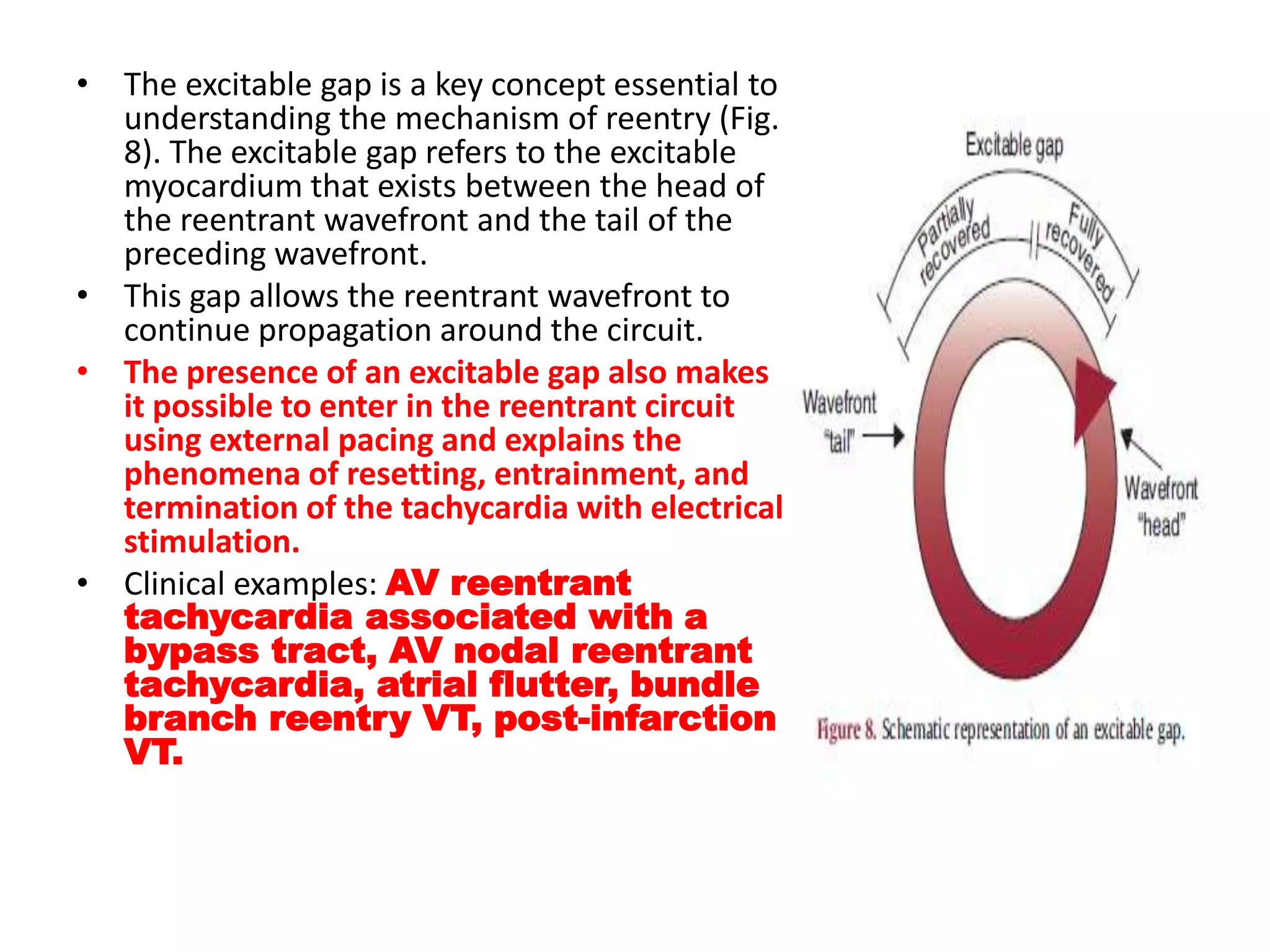 Mechanism of arrythmias | PPTX