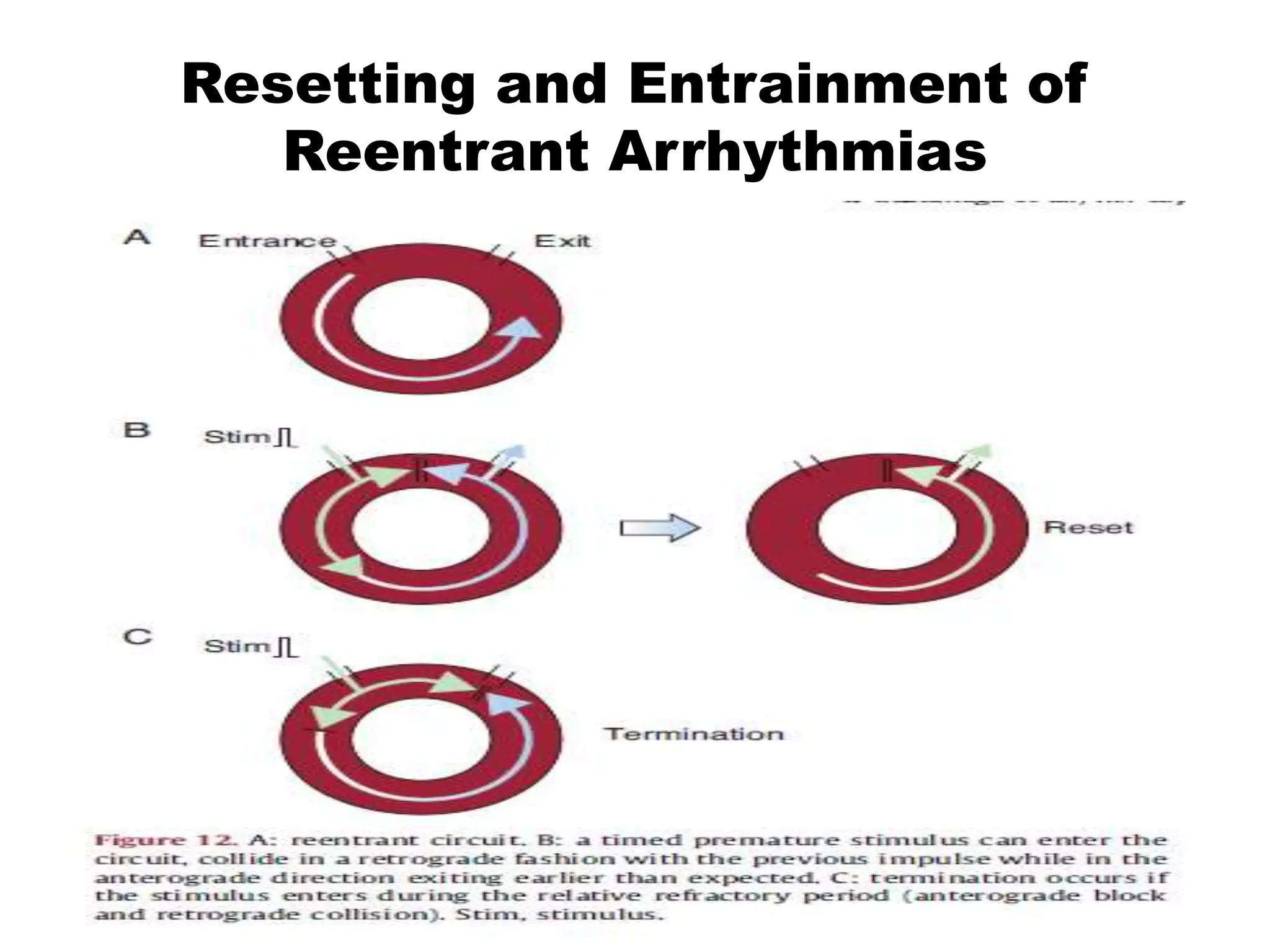 Mechanism of arrythmias | PPTX