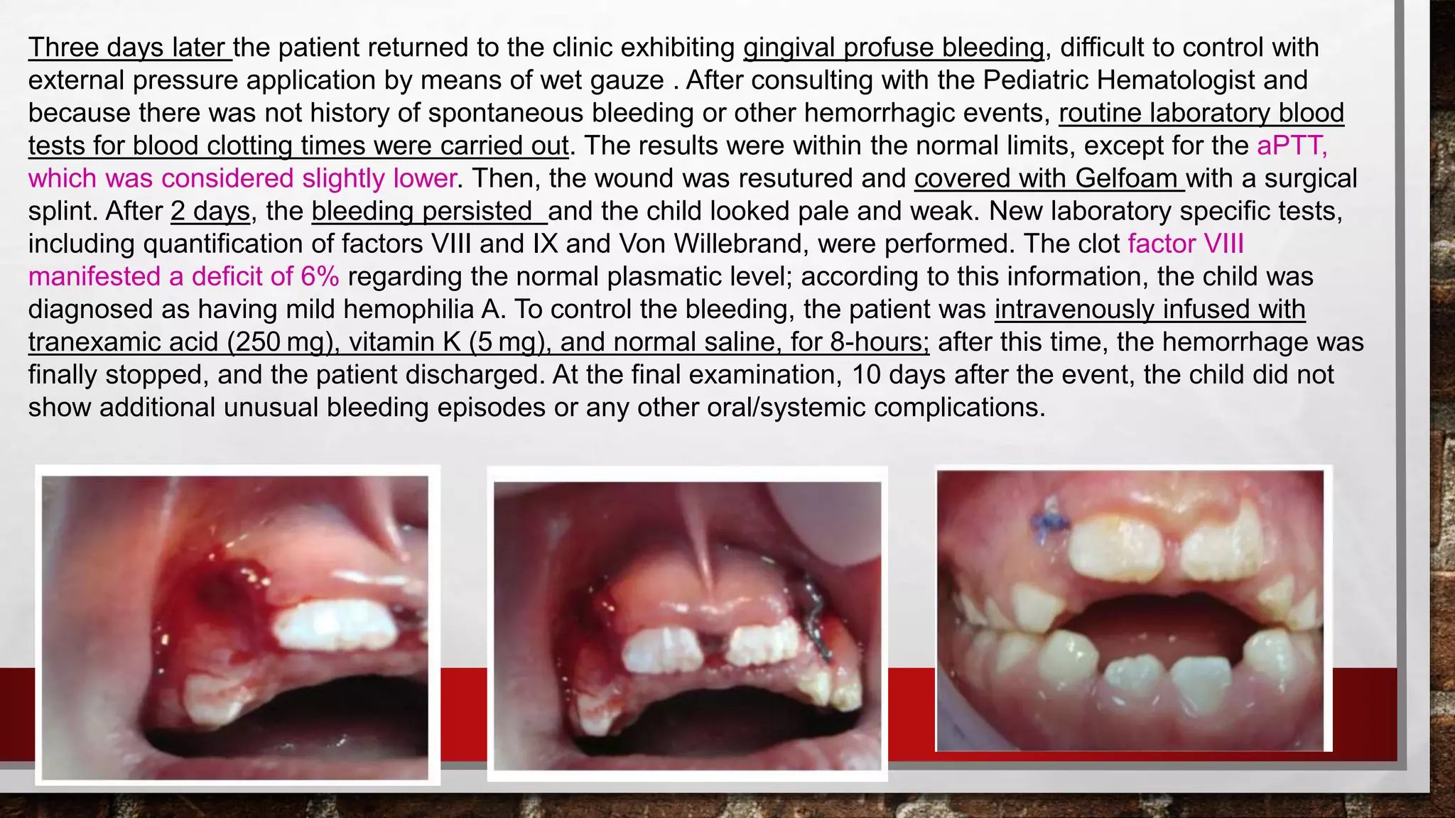 Mechanism of blood clotting and blood dyscrasias | PPTX