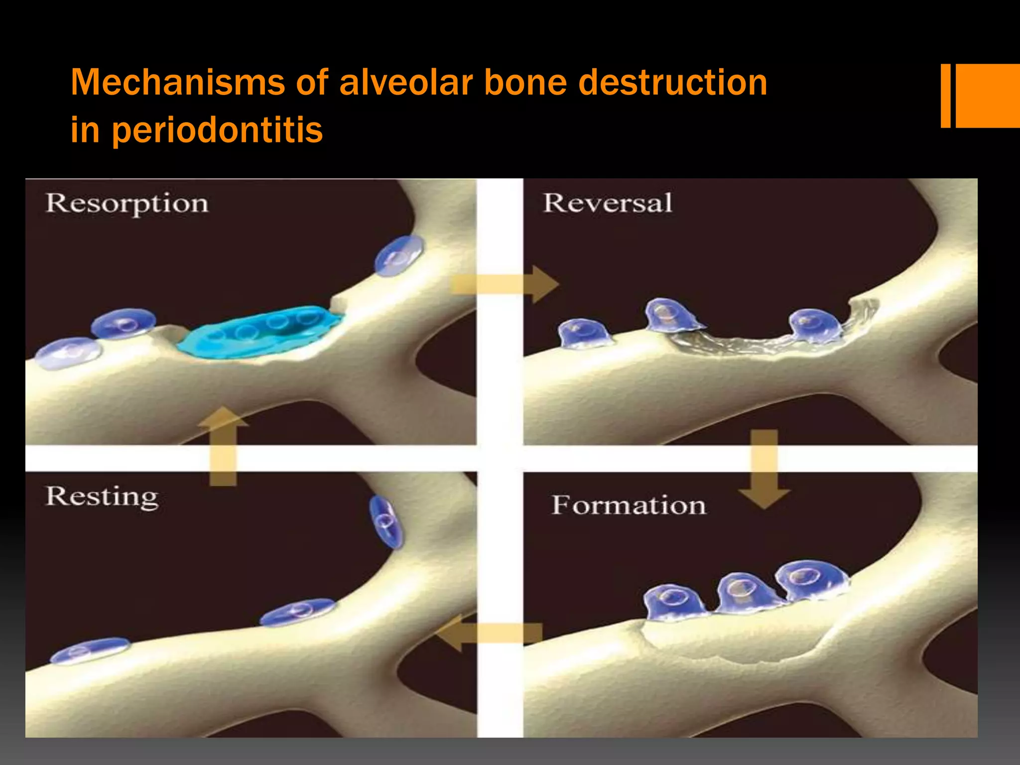 Mechanism of bone loss and patterns of bone loss | PPTX
