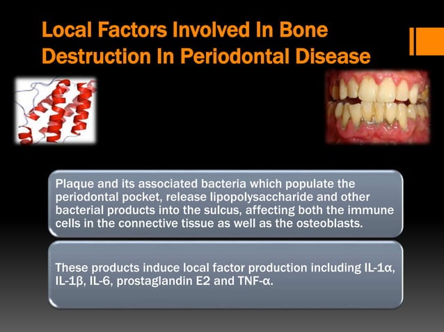 Mechanism of bone loss and patterns of bone loss | PPT