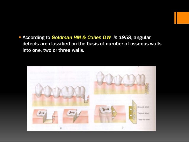 Mechanism of bone loss and patterns of bone loss