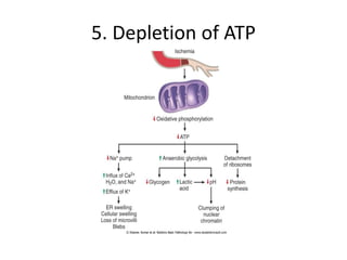 Mechanism of cell injury Pathophysiology | PDF