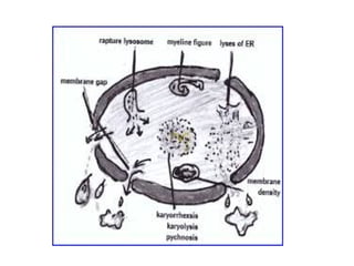 Mechanism of Cell Injury - Pathology powerpoint | PPTX