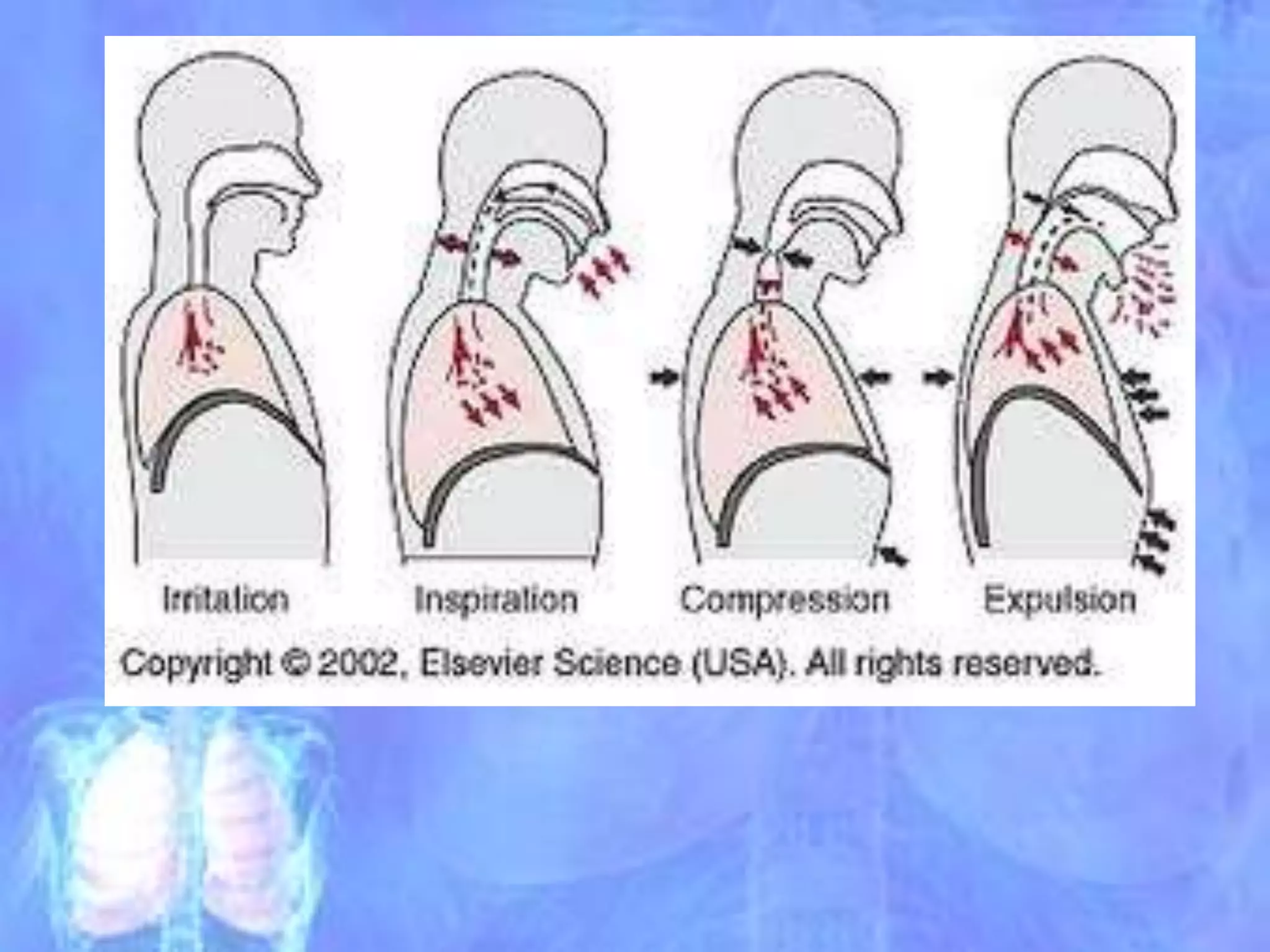 Mechanism of Cough | PPT