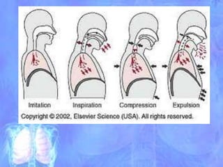 Mechanism of Cough | PPTX