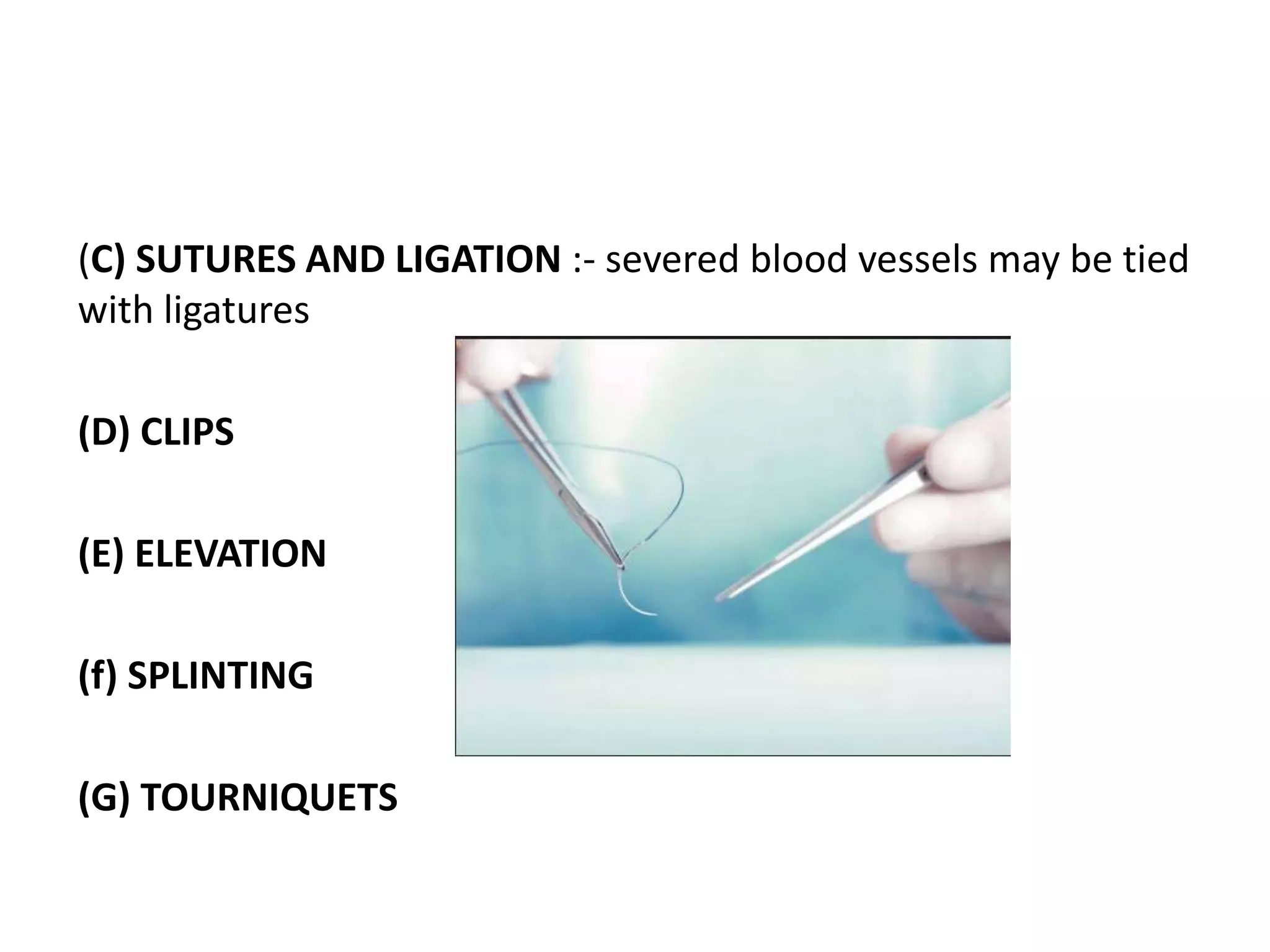 Mechanism of haemostasis , fibrinolysis and method to control ...