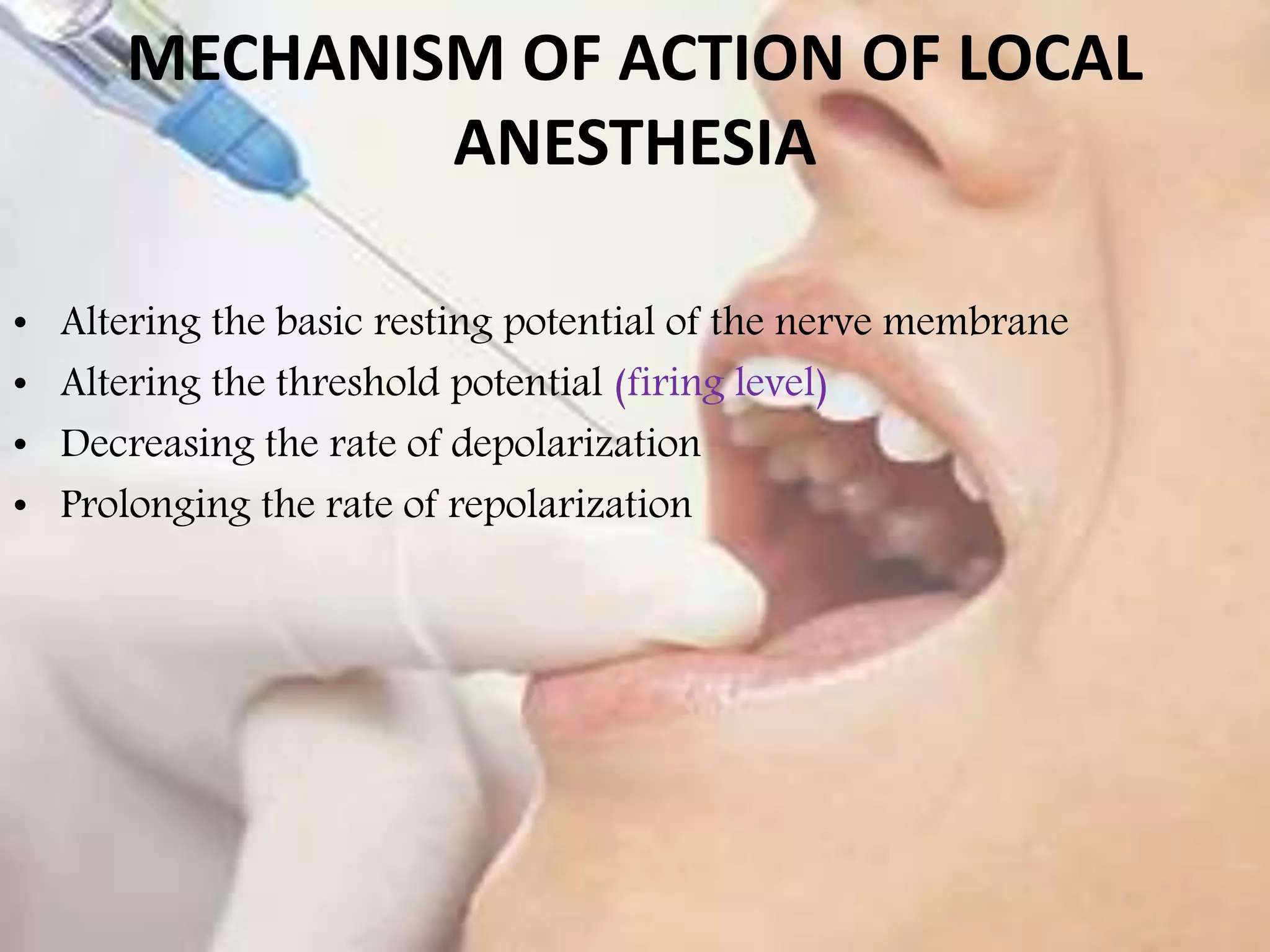 Mechanism of local anesthesia | PPTX