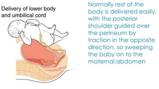 Mechanism of labor | PDF