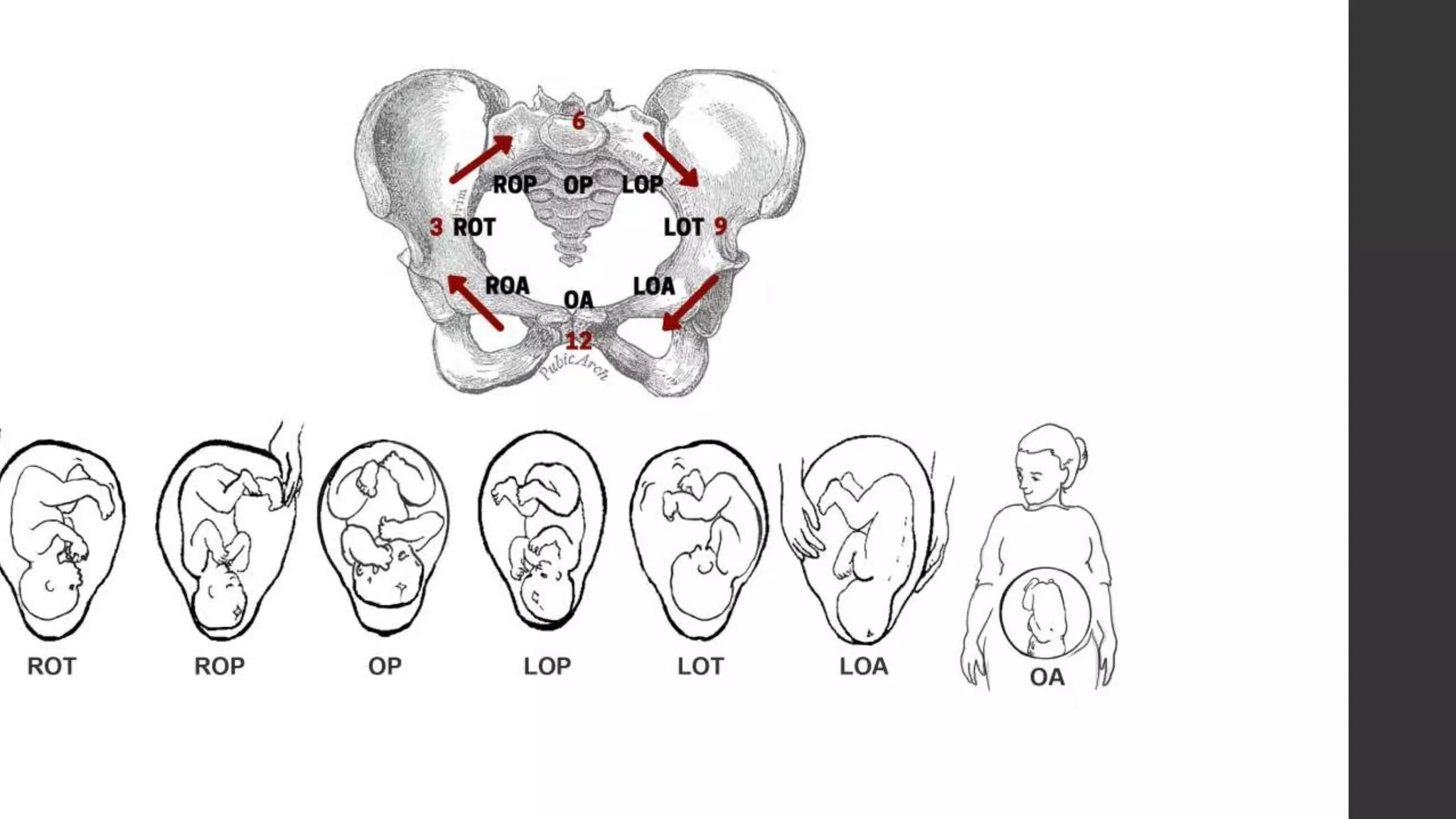 Mechanism of labor | PPTX