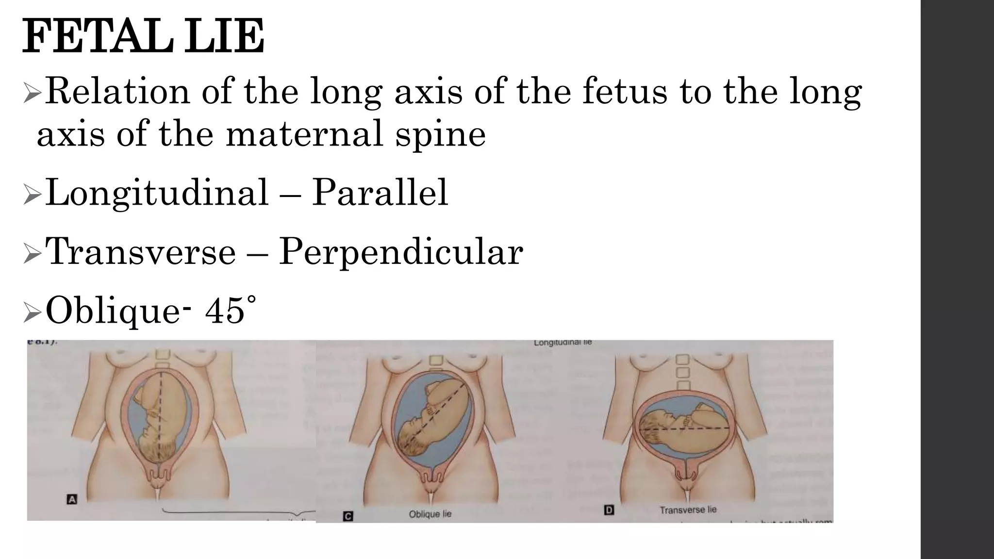 Mechanism of labor | PPTX