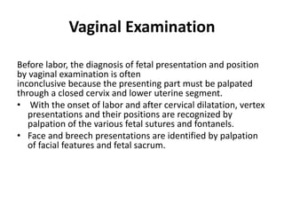 Mechanism of labor | PPSX