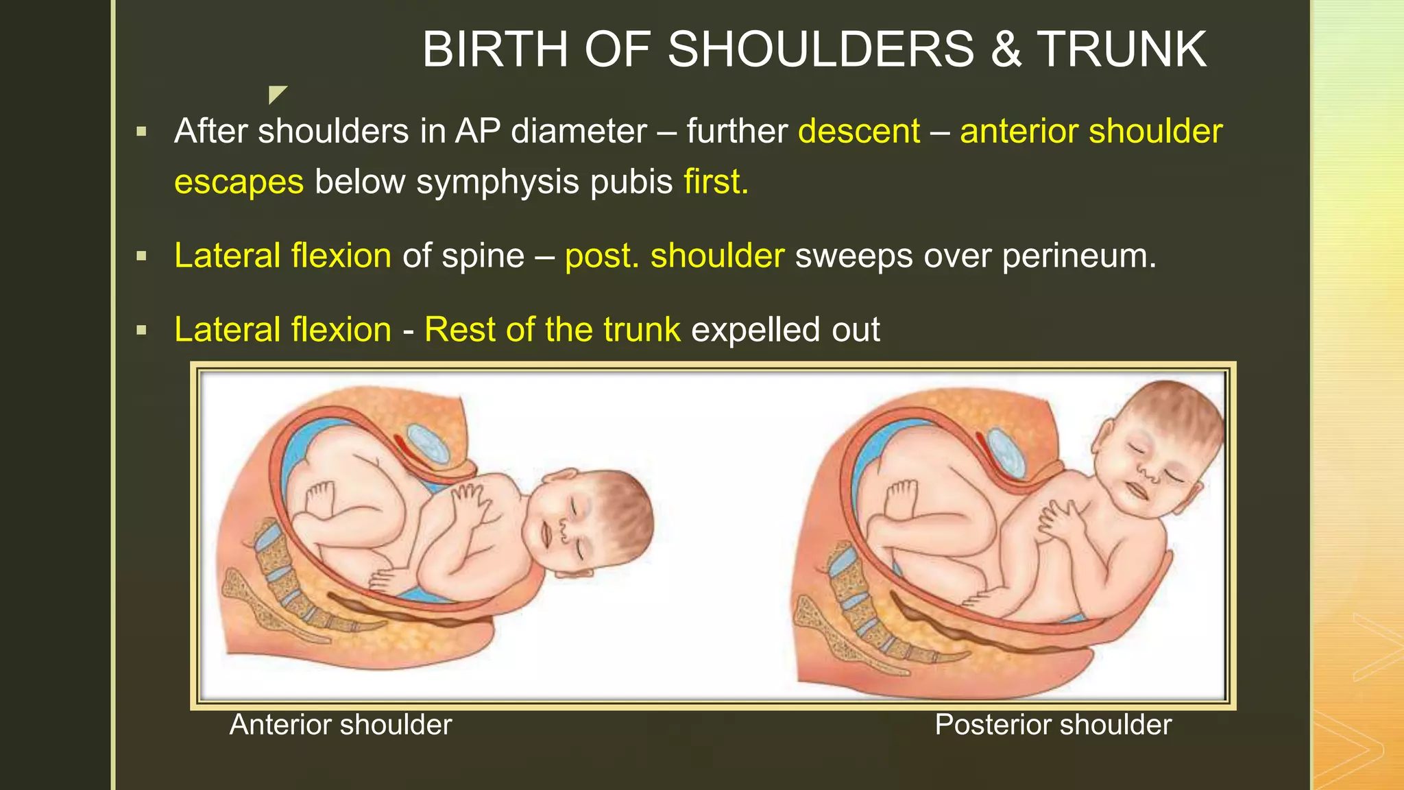 Postition of fetus and Mechanism of labor | PPTX