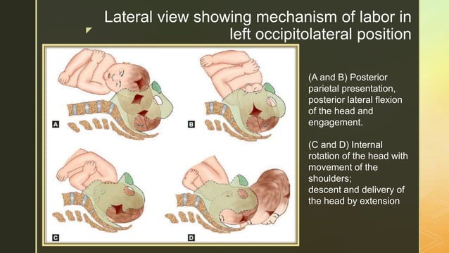Postition of fetus and Mechanism of labor | PPTX | Pregnancy ...