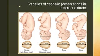 Postition of fetus and Mechanism of labor | PPTX