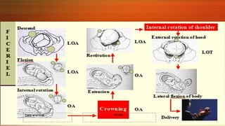 The Mechanism of Normal Labor class.pptx