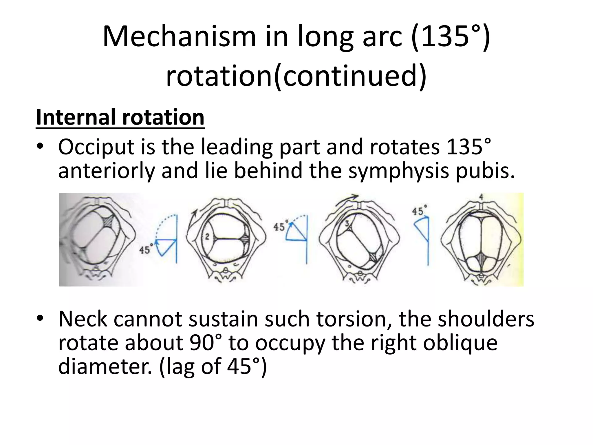 Mechanism of labor in right occipito posterior position | PPTX