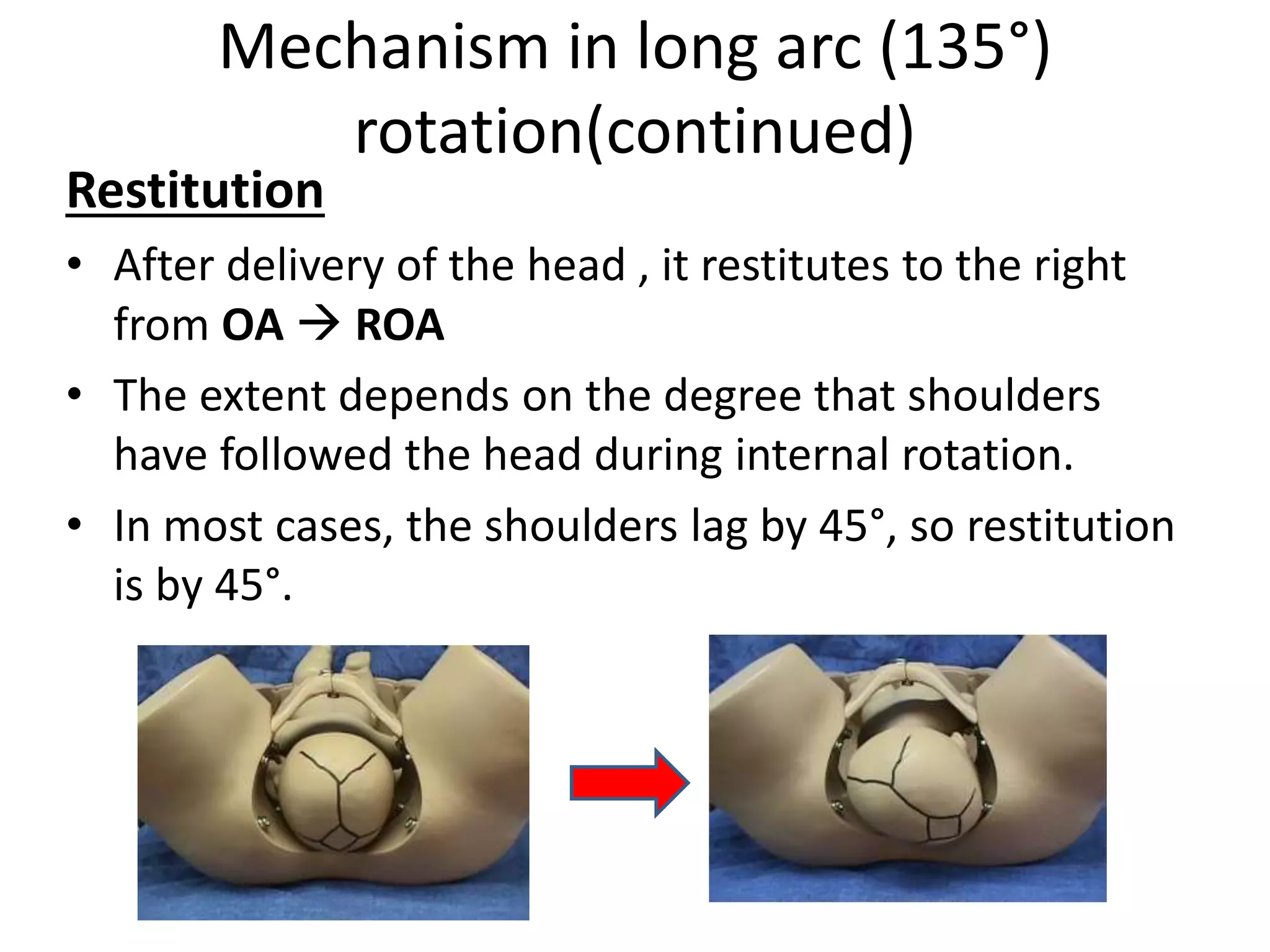 Mechanism of labor in right occipito posterior position | PPTX
