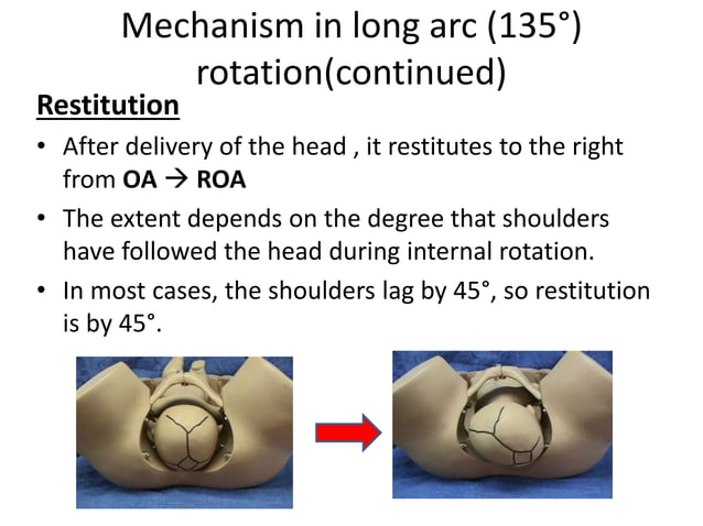 Mechanism of labor in right occipito posterior position | PPTX ...