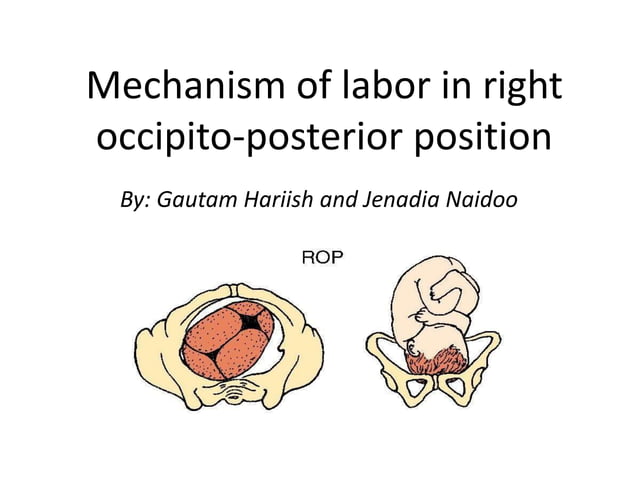 Mechanism of labor in right occipito posterior position | PPT