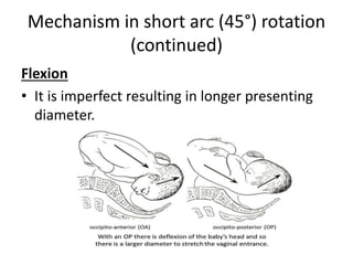 Mechanism of labor in right occipito posterior position | PPT