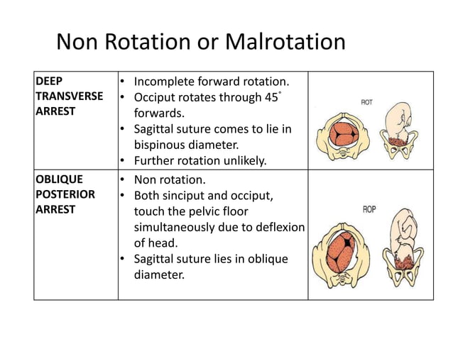 Mechanism of labor in right occipito posterior position | PPT
