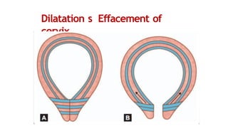 mechanism of labor_ppt.pptx a reference for Maternal and Child | PPTX