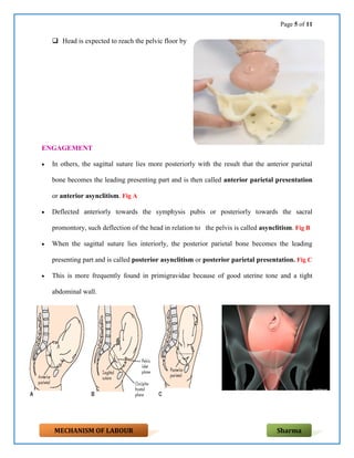 Mechanism of labour | PDF