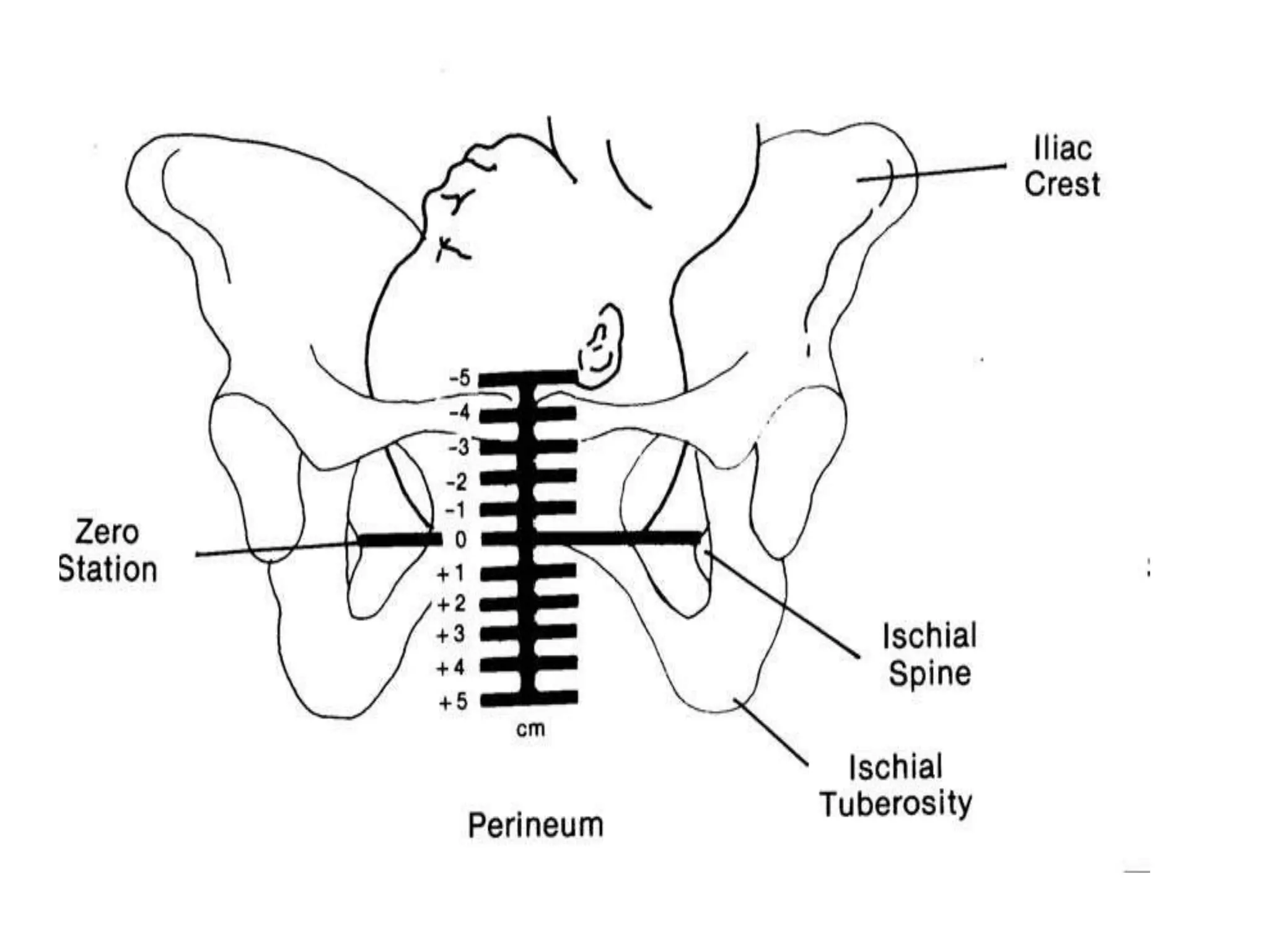 Mechanism of labour | PPTX
