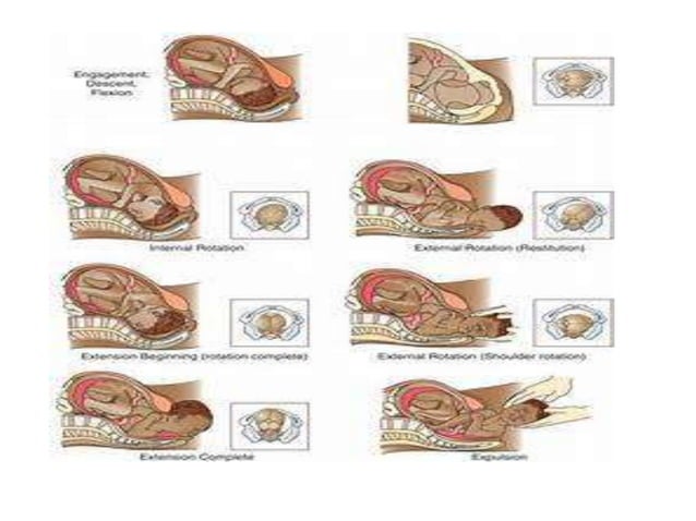 Mechanism of labour | PPTX