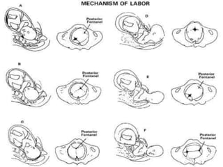MECHANISM OF LABOUR.ppt