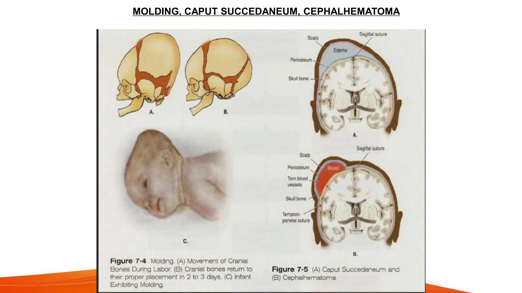 MECHANISM OF LABOUR.pptxcvzzdbfgffsssgsgsgsg | PPTX