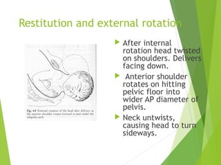 Mechanism of labour and use of partogram | PPT