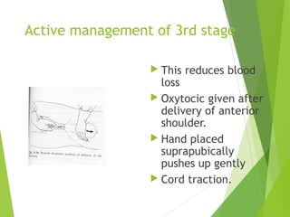 Mechanism of labour and use of partogram | PPT