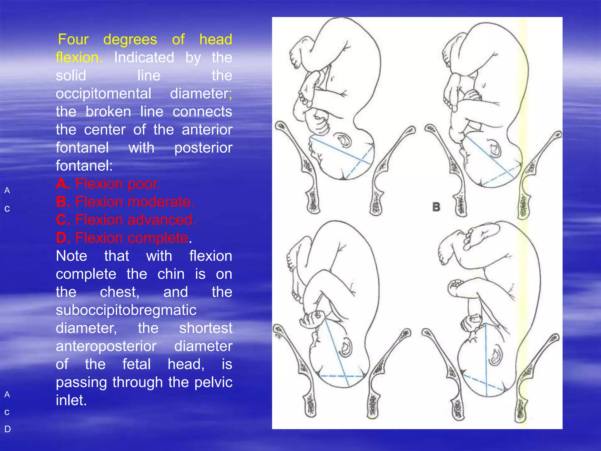 MECHANISM OF LABOUR (NORMAL and ABNORMAL).ppt