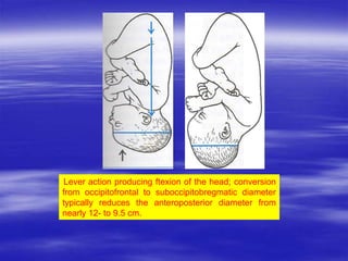 MECHANISM OF LABOUR (NORMAL and ABNORMAL).ppt