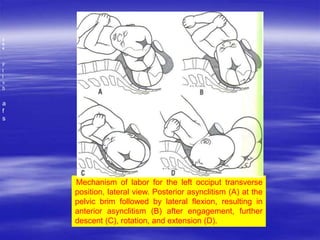 MECHANISM OF LABOUR (NORMAL and ABNORMAL).ppt