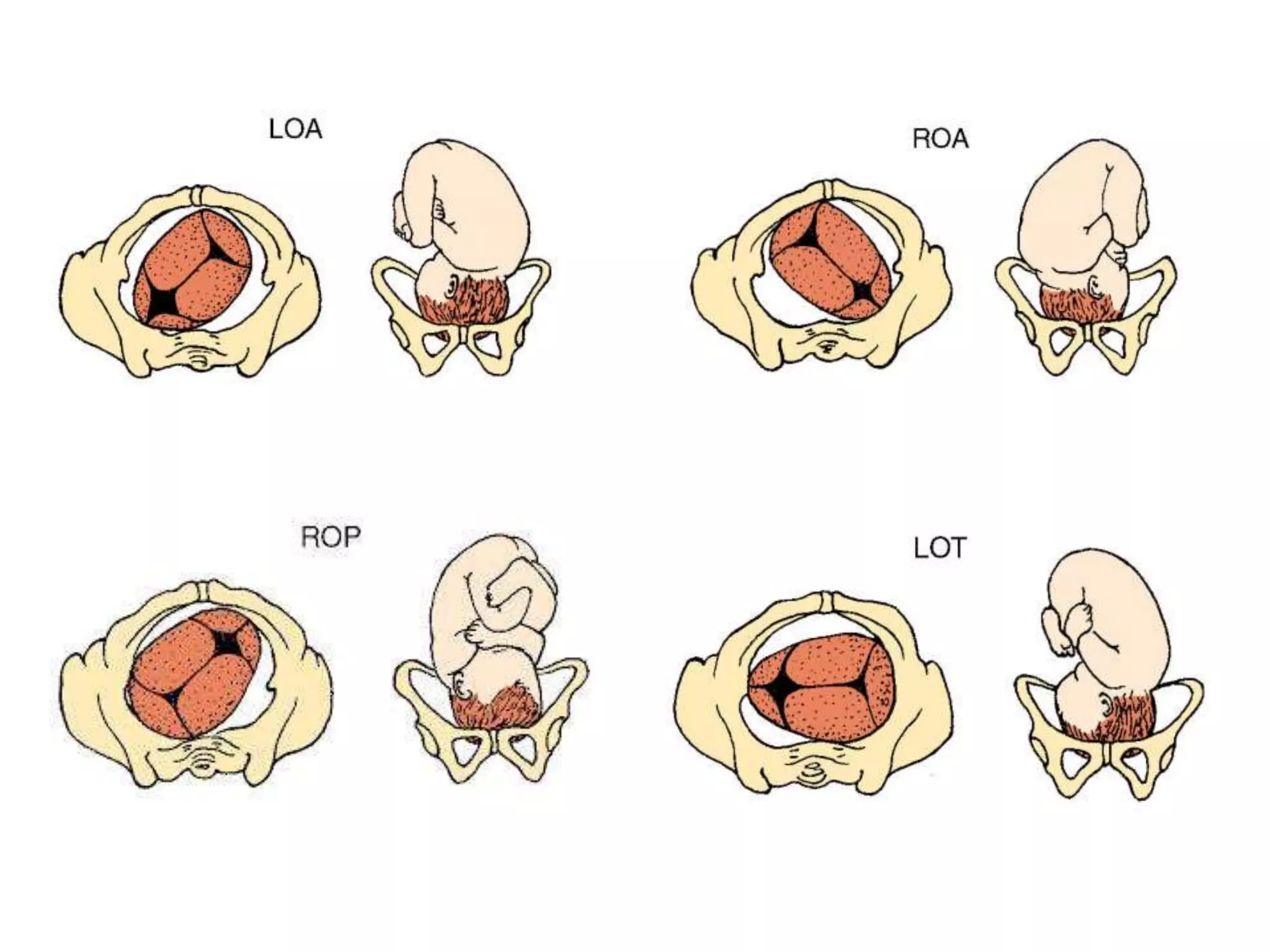Mechanism of normal labour | PPT
