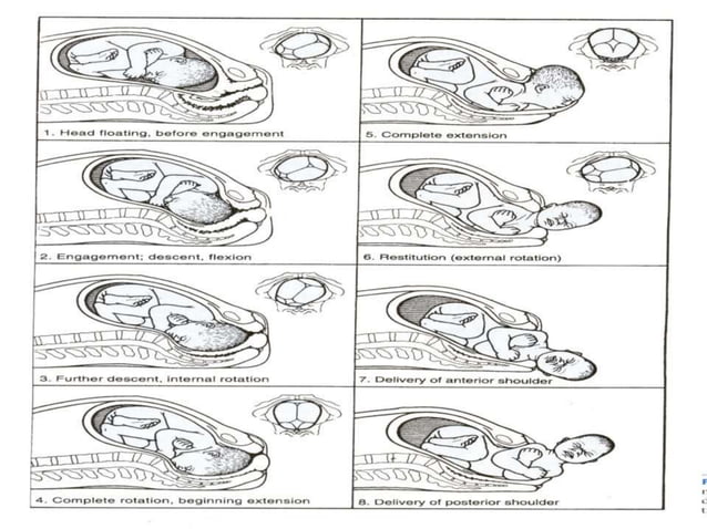 Mechanism of normal labour