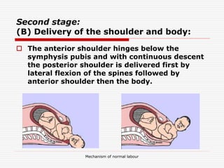 Mechanism of normal labour-Ramy.ppt
