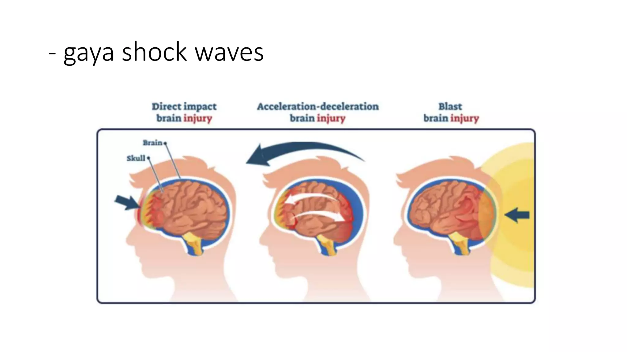 Mechanism of TBI.pptx