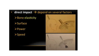 Mechanism of TBI.pptx