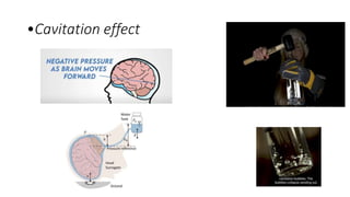 Mechanism of TBI.pptx