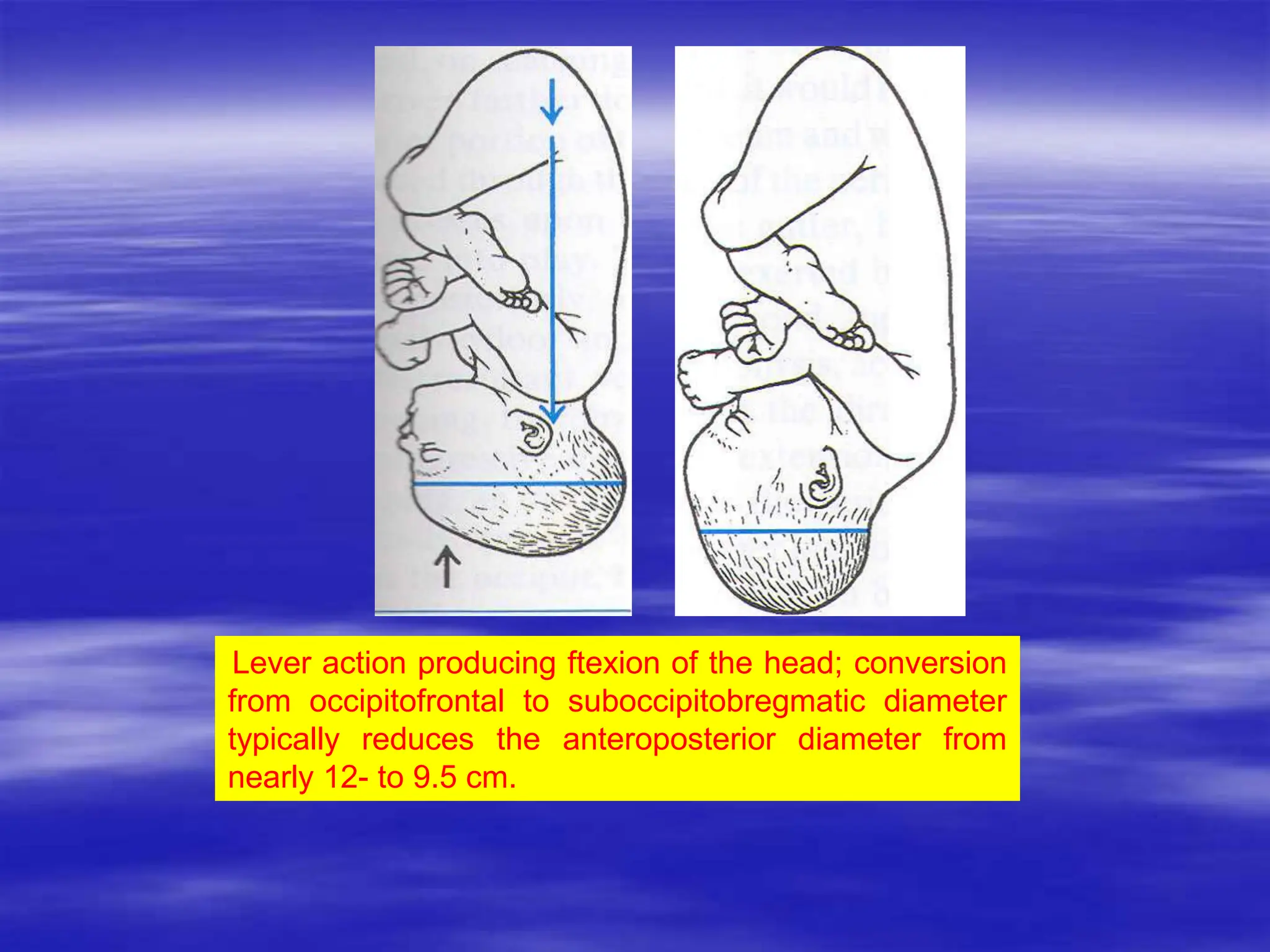 MECHANISMOF THE NORMAL AND ABNORMAL LABOUR.ppt