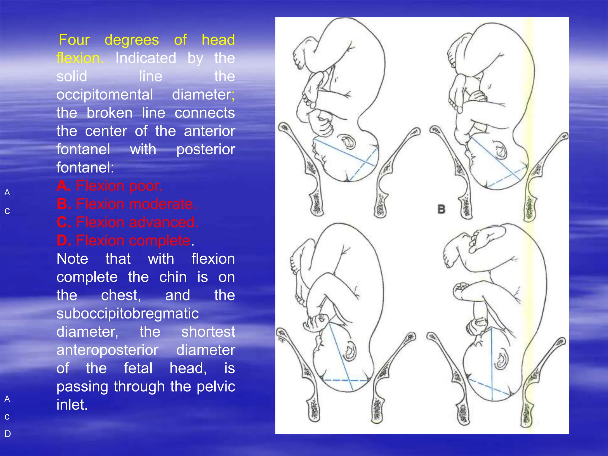 MECHANISMOF THE NORMAL AND ABNORMAL LABOUR.ppt