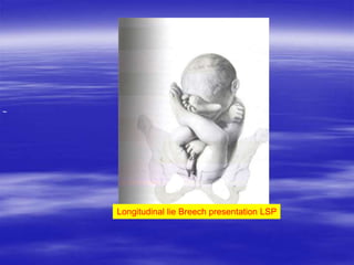 MECHANISMOF THE NORMAL AND ABNORMAL LABOUR.ppt